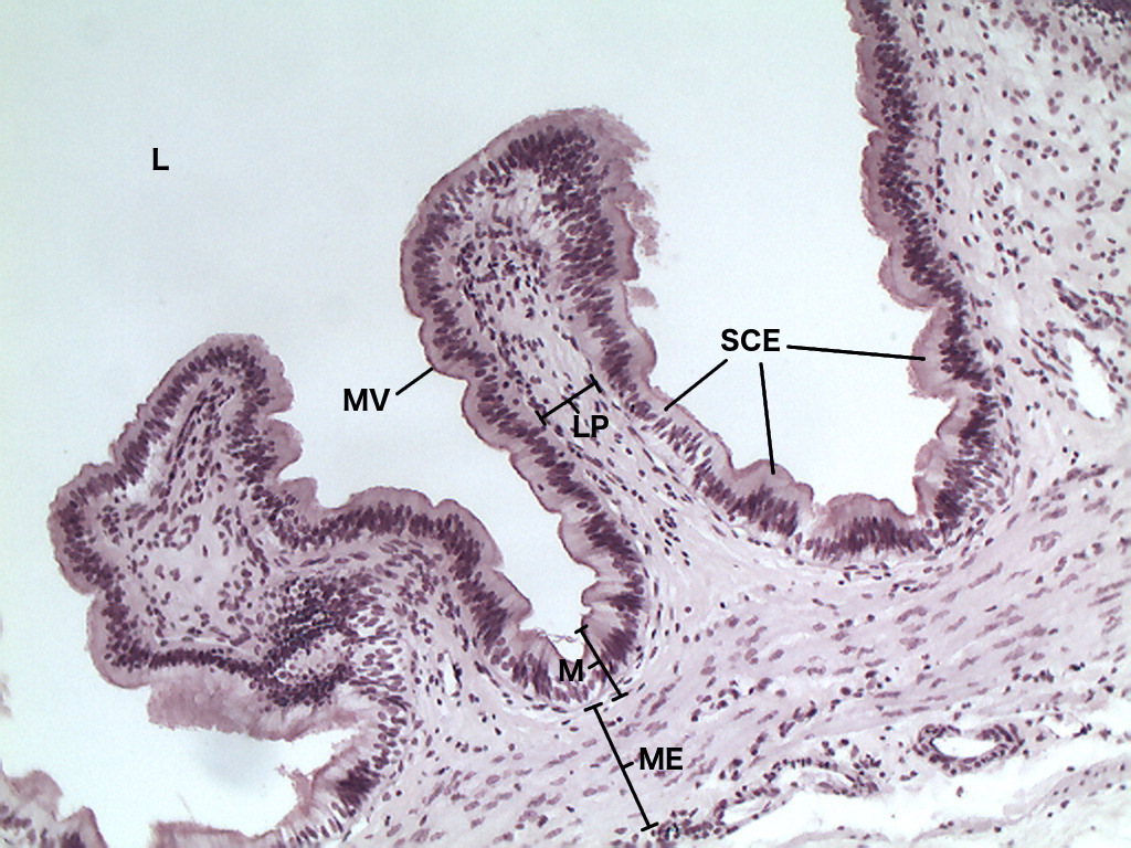 Gallbladder Labeled Histology Dictionary Normal: Gallbladder The